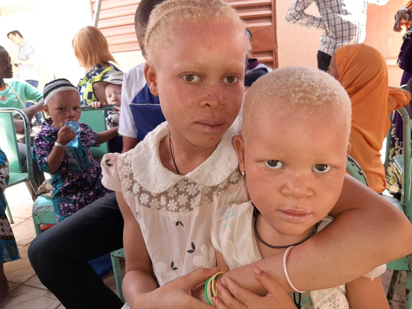 Journée internationale de sensibilisation sur l'albinisme